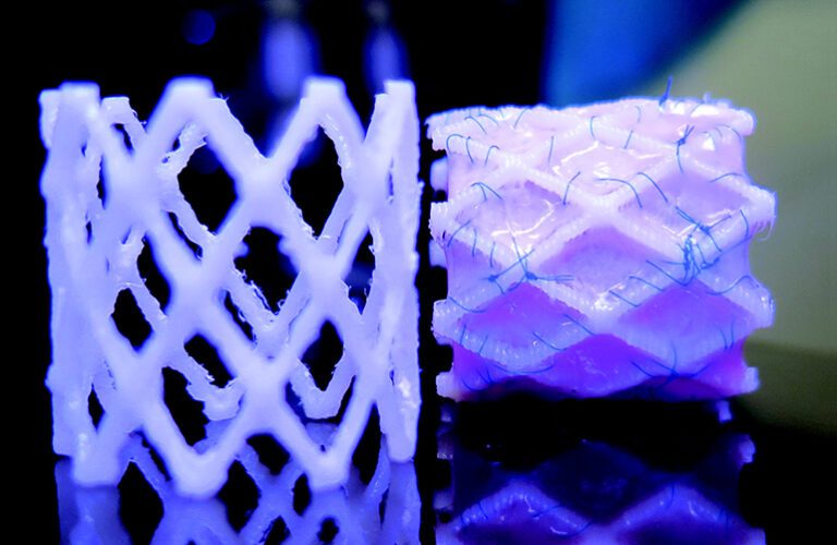 3D Printed Stents for Children That Grow With Patient's Vessels ...